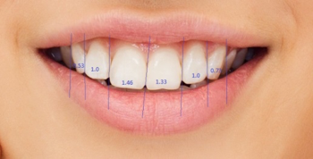 Cosmetic Smile Analysis - Harper Dental & Orthodontics